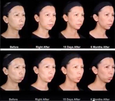 Mauricio de Maio - MD Codes Workshop | VENENCLINIC